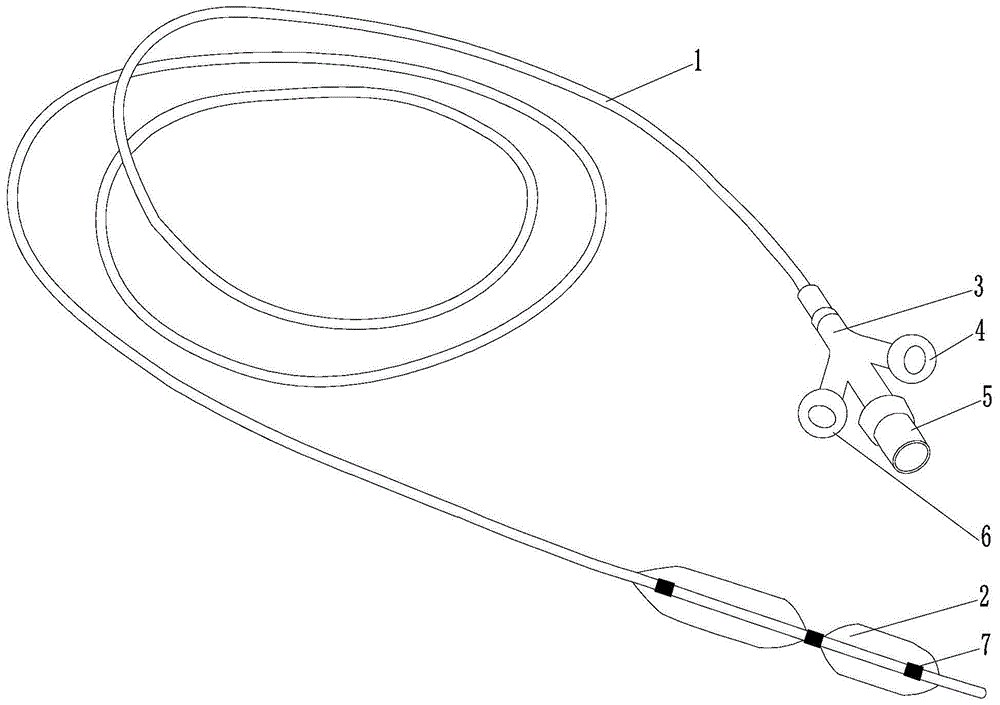 介入导管结构 - 安骏医疗